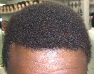 African American Hair Systems – NOBO Corporation